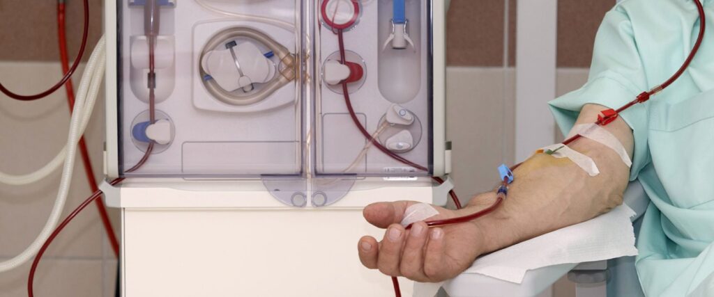 How Does Dialysis Work? - Mobil Dialysis